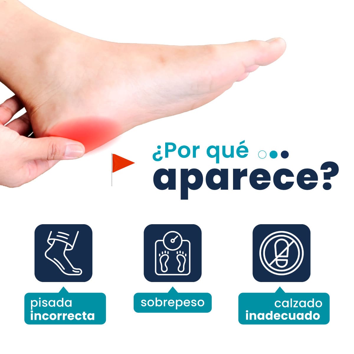 Espolón calcáneo: Qué es, síntomas y tratamientos efectivos - Decapie